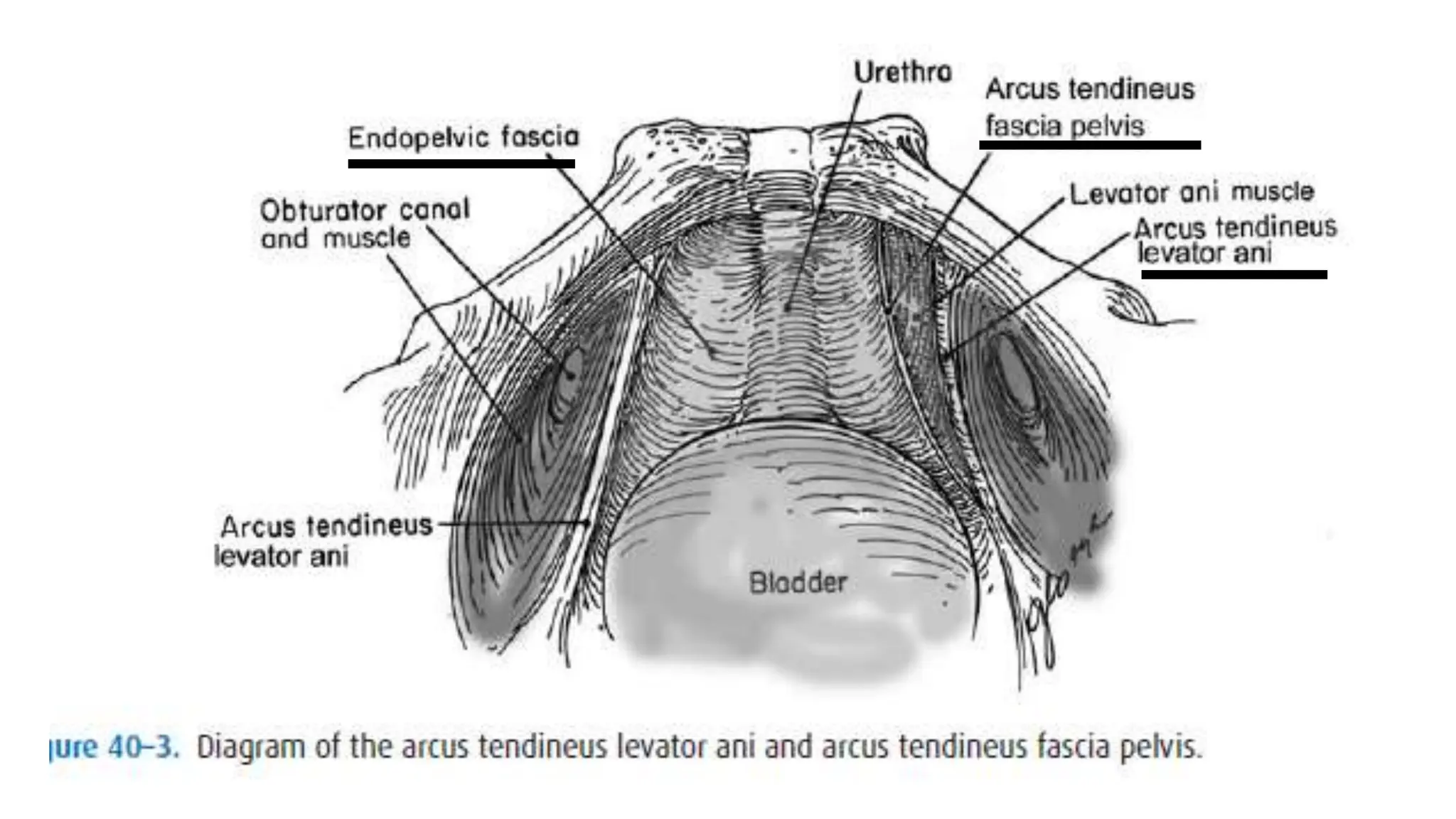 Surgical Anatomy of female pelvis.pptx