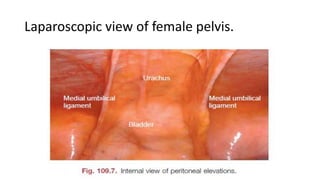 Surgical Anatomy of female pelvis.pptx