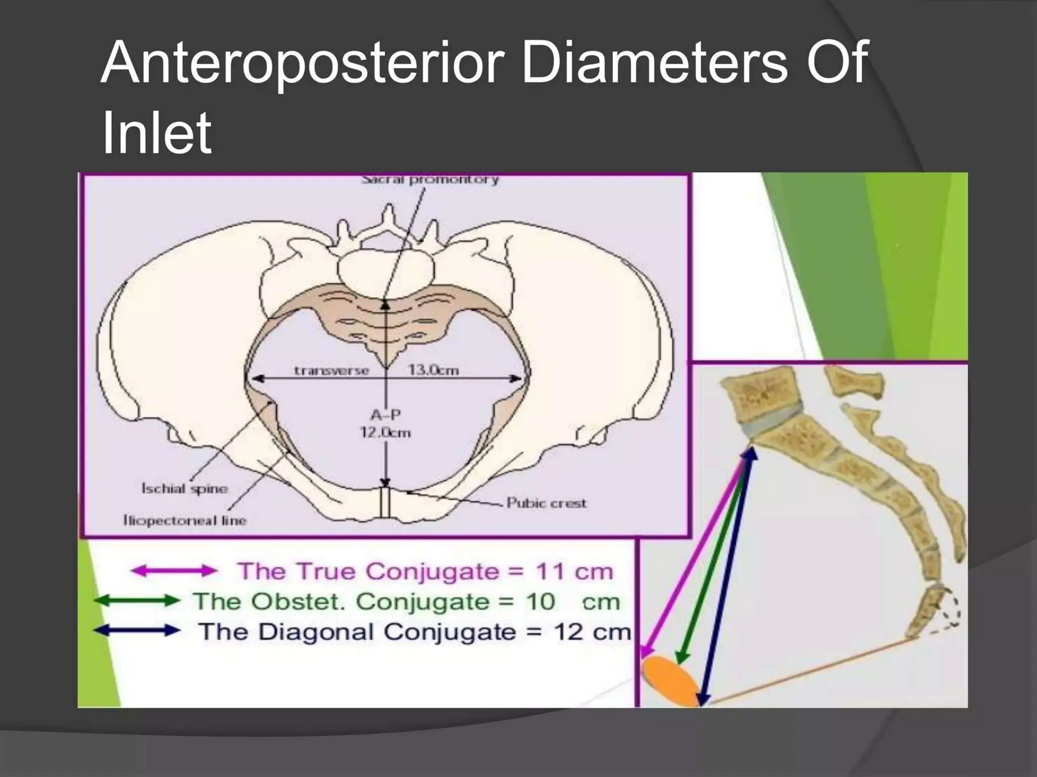 Anatomy of female pelvis female pelvis is wider | PPT