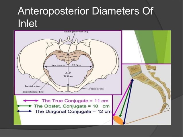 Anatomy of female pelvis and Fetal Diameters 2020.pptx