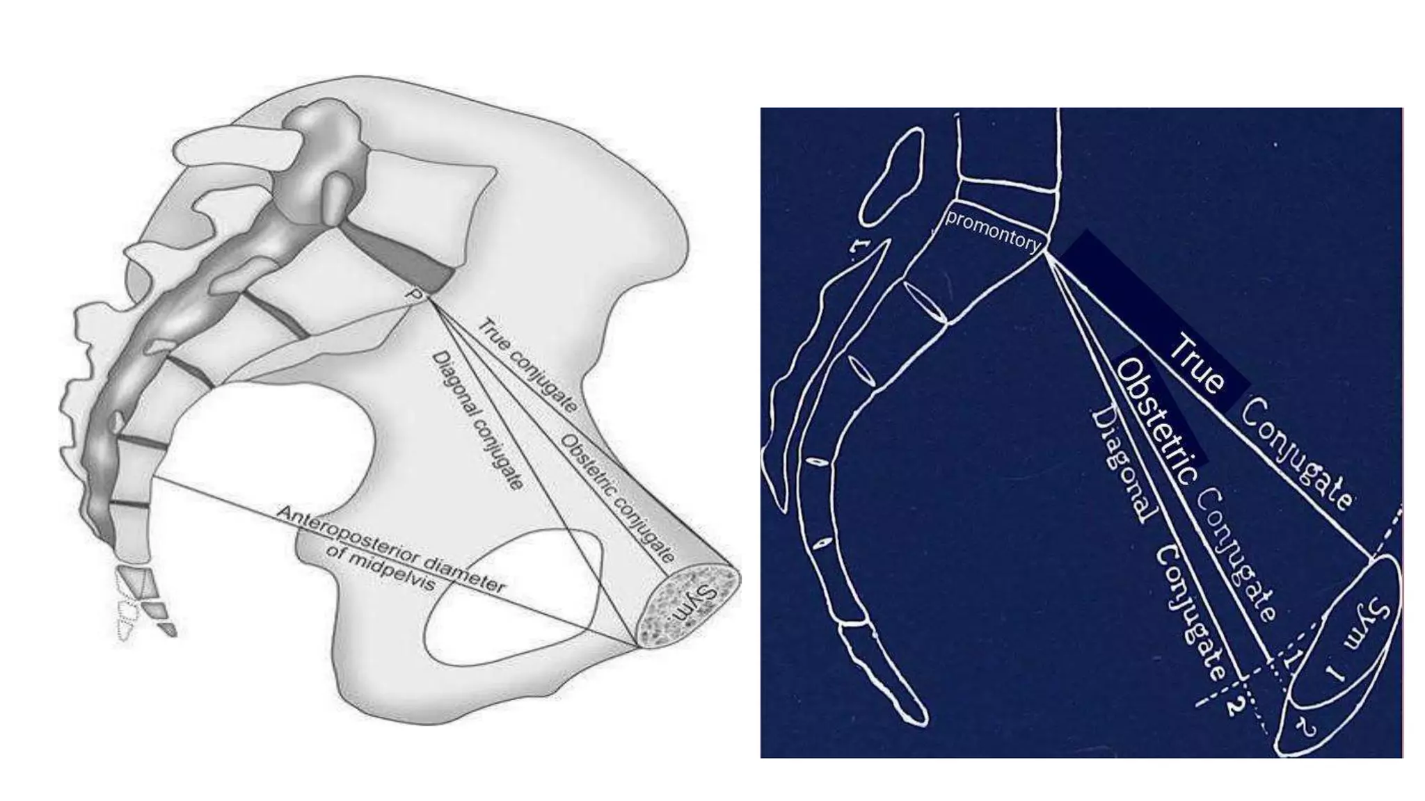 anatomy of female plevis.pptx