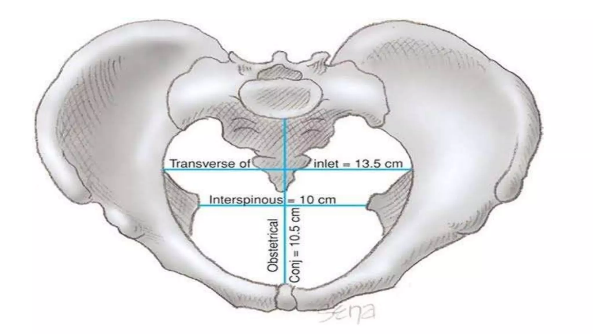 anatomy of female plevis.pptx