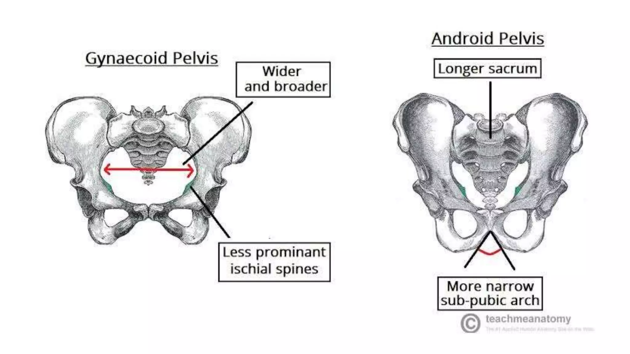 anatomy of female plevis.pptx