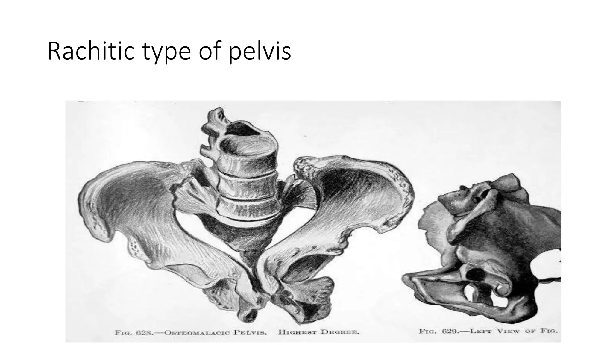 anatomy of female plevis.pptx