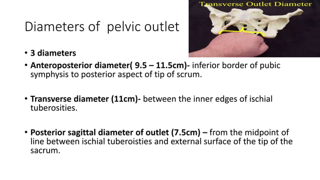 anatomy of female plevis.pptx