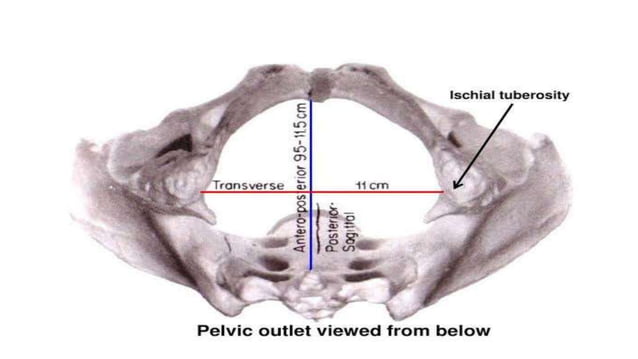 anatomy of female plevis.pptx