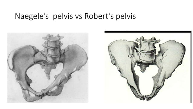 anatomy of female plevis.pptx