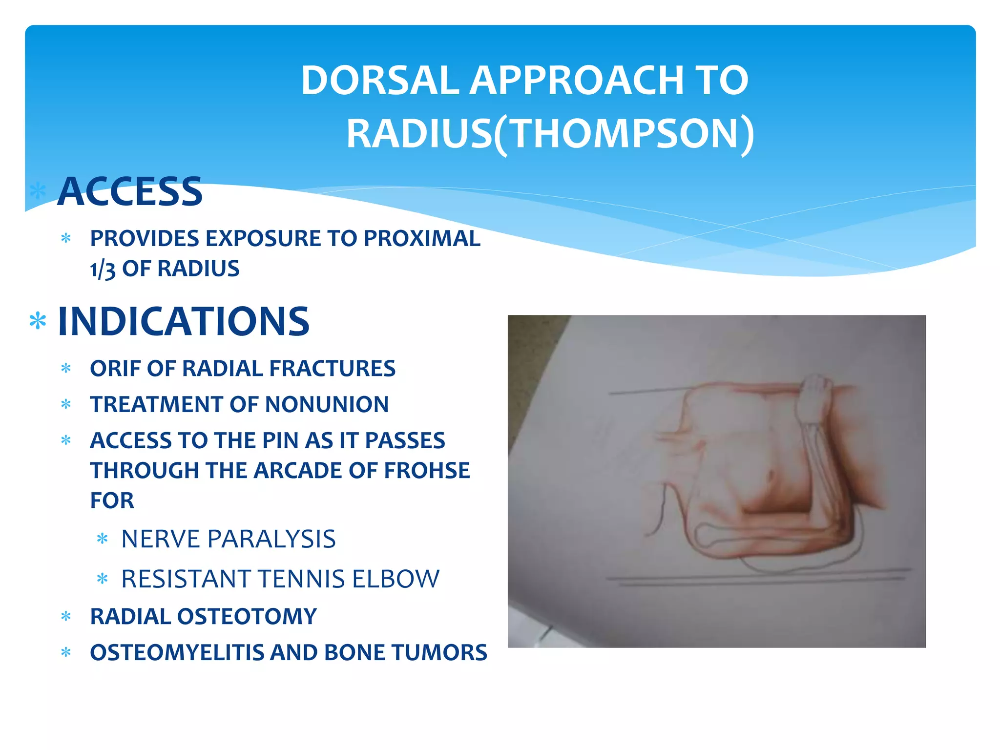 Anatomy of forearm | PPTX