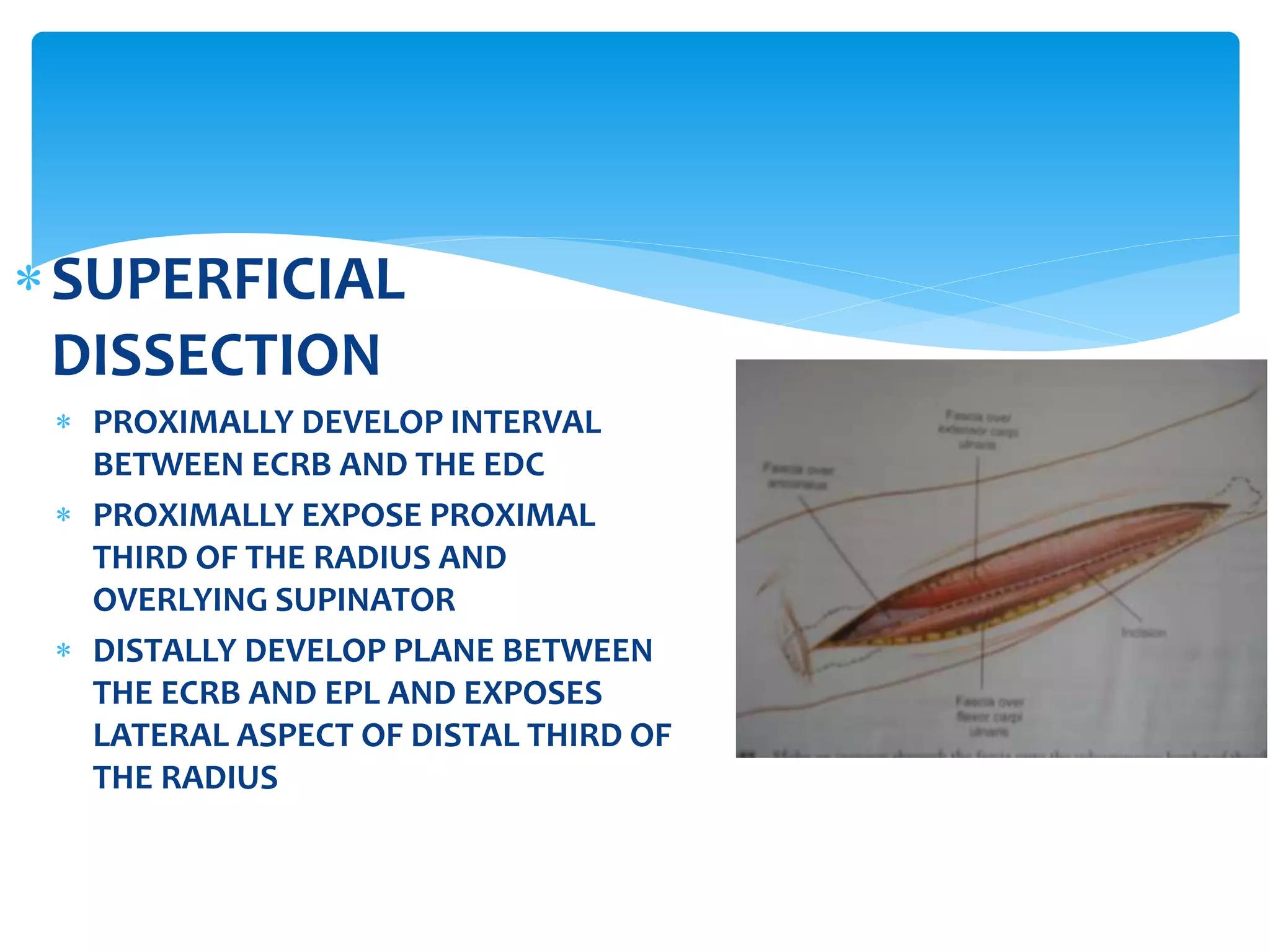 Anatomy of forearm | PPTX