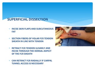 Anatomy of forearm | PPTX