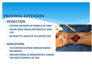 Anatomy of forearm | PPTX