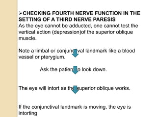 Anatomy of fourth and sixth cranial nerve 06.12.13