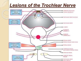 Trochlear Nerve Pathway