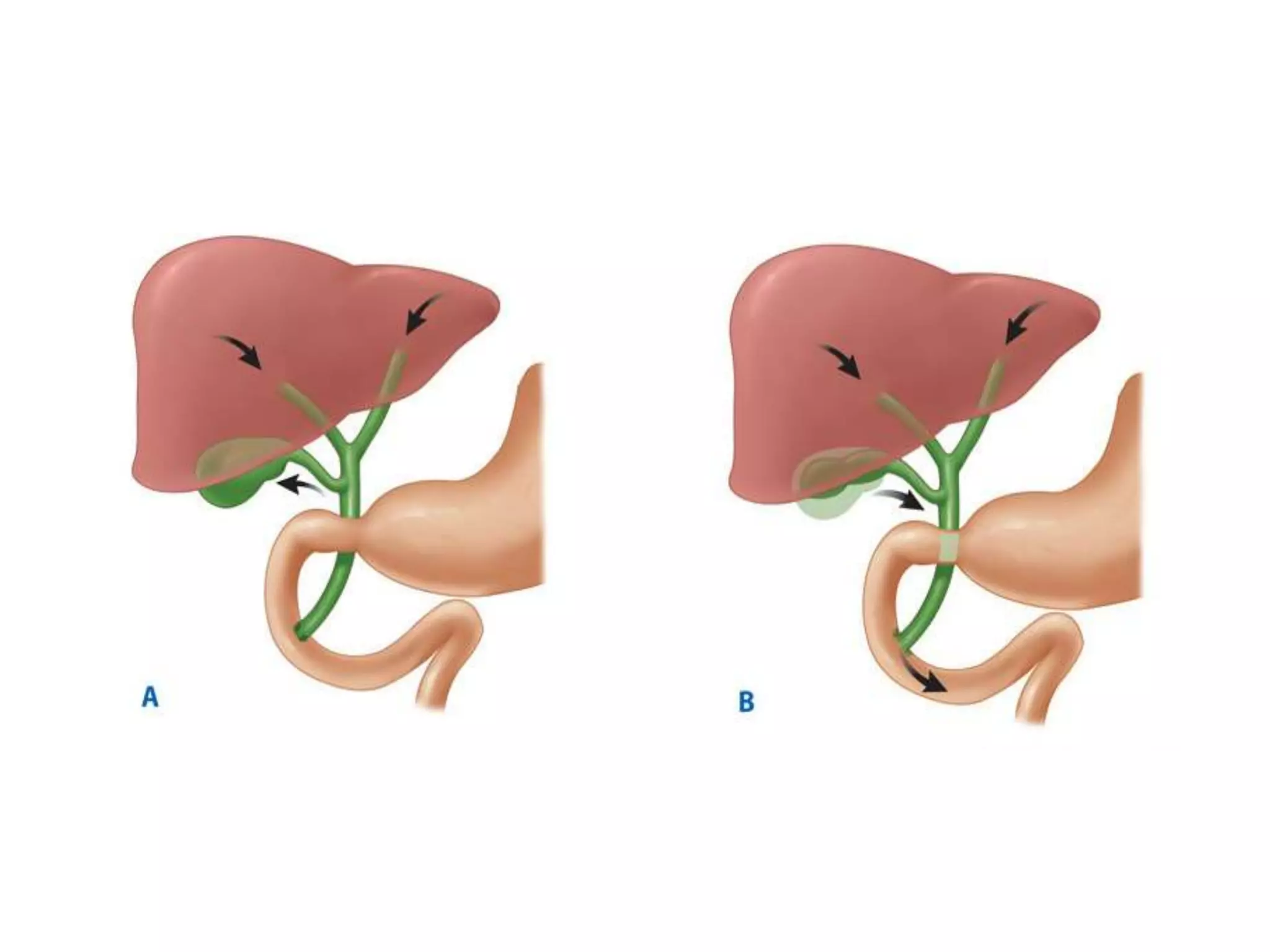 Anatomy of gall bladder | PPTX