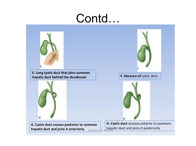 Anatomy of gall bladder | PPTX