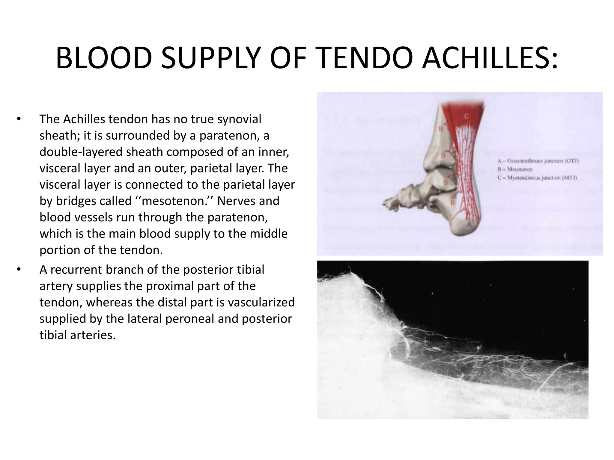ANATOMY OF GASTROCSOLEUS COMPLEX AND TEAR OF TENDO.pptx