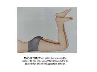 ANATOMY OF GASTROCSOLEUS COMPLEX AND TEAR OF TENDO.pptx