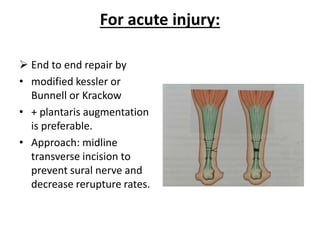 ANATOMY OF GASTROCSOLEUS COMPLEX AND TEAR OF TENDO.pptx