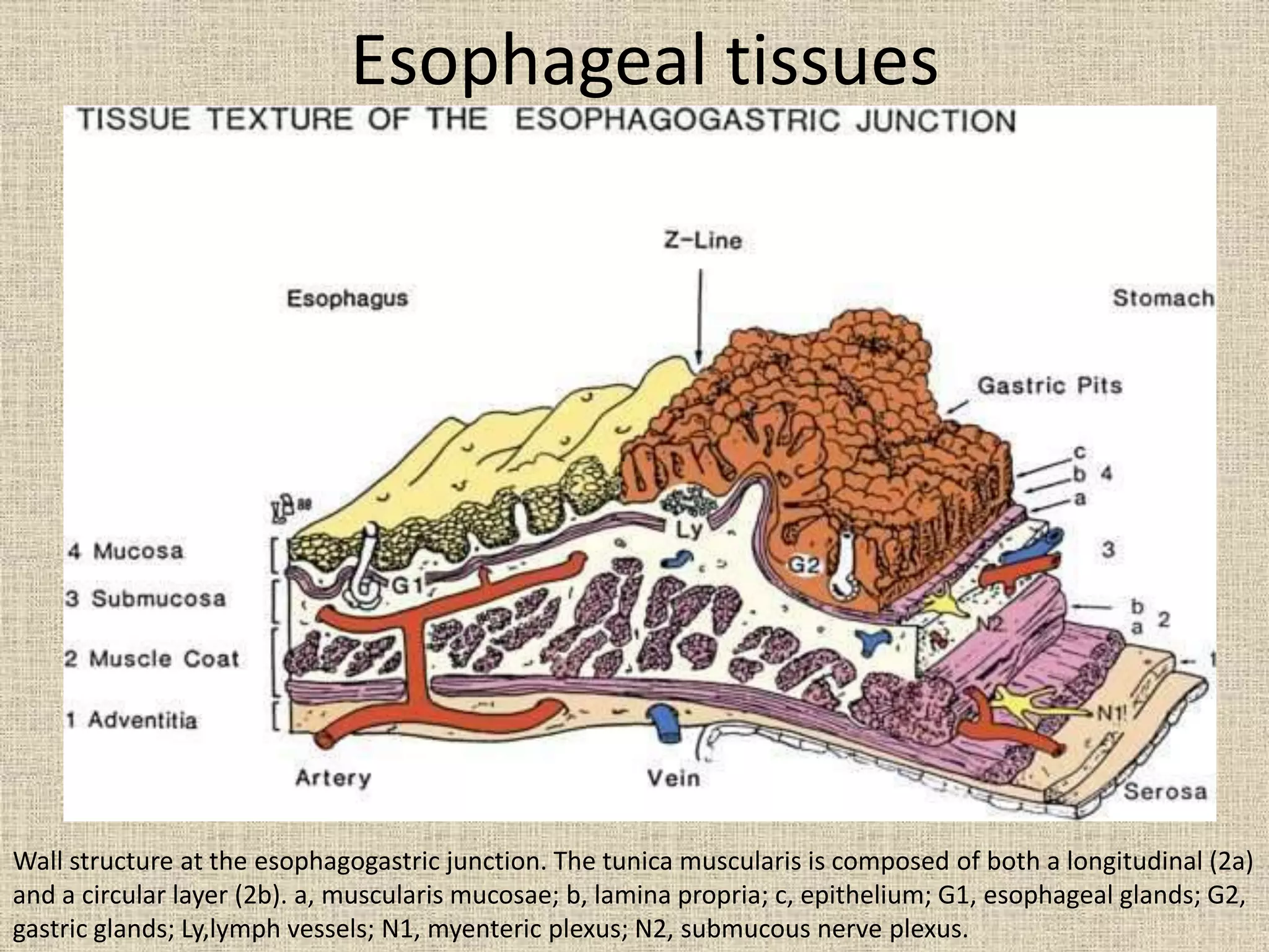 Anatomy of gastroesophagial junction with specail reference to hiatus ...