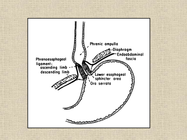 Anatomy of gastroesophagial junction with specail reference to hiatus ...