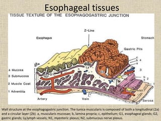 Gastroesophageal Junction Slide