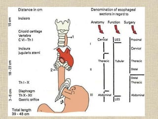 Gastroesophageal Junction Slide Labeled
