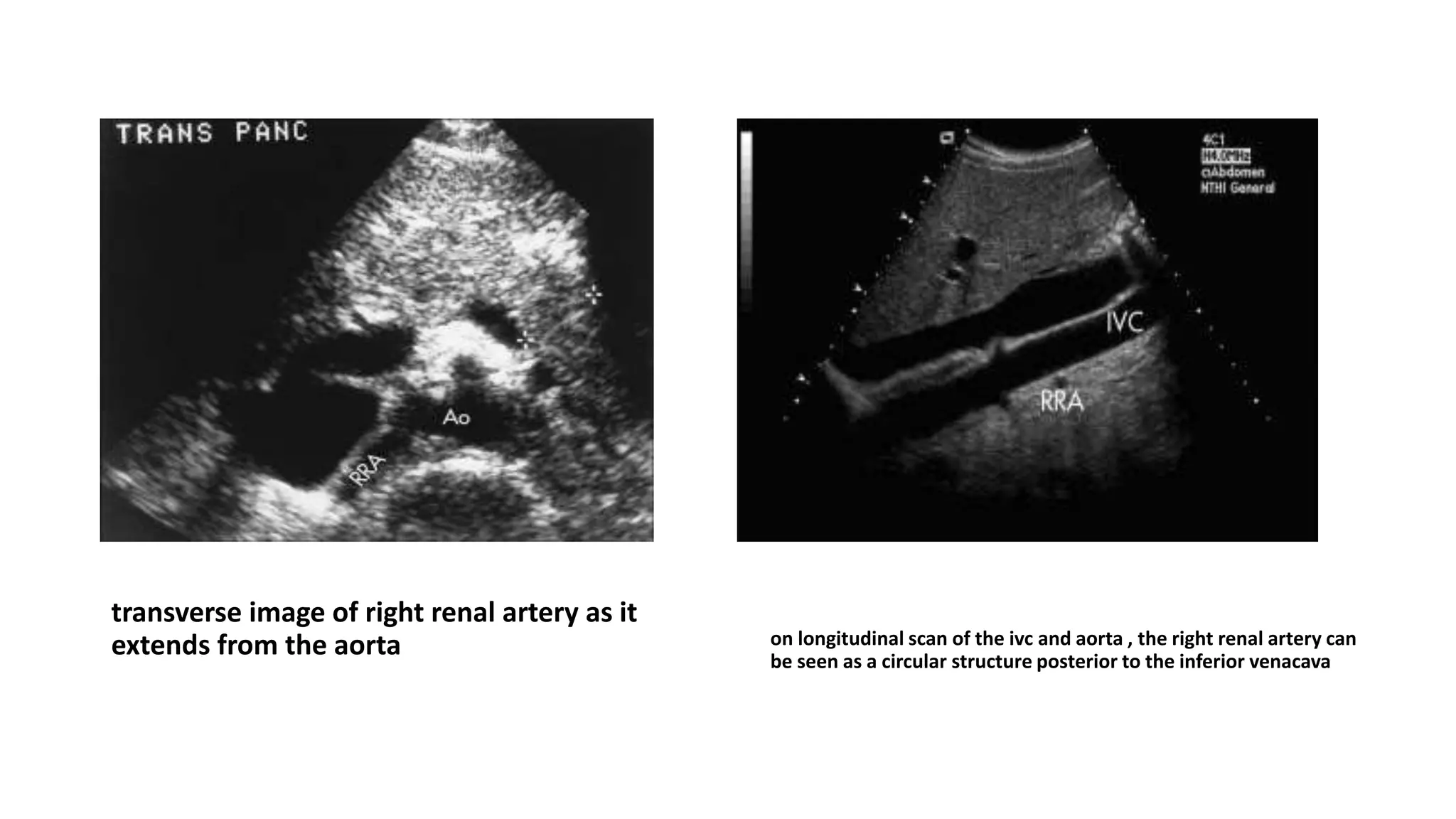 Anatomy of genitourinary system | PPTX