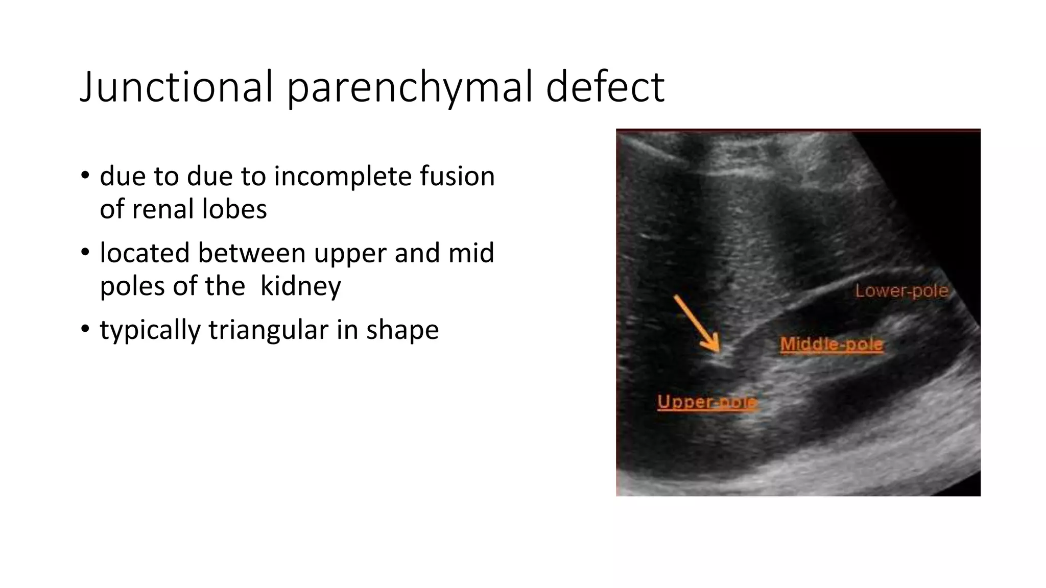 Anatomy of genitourinary system | PPTX