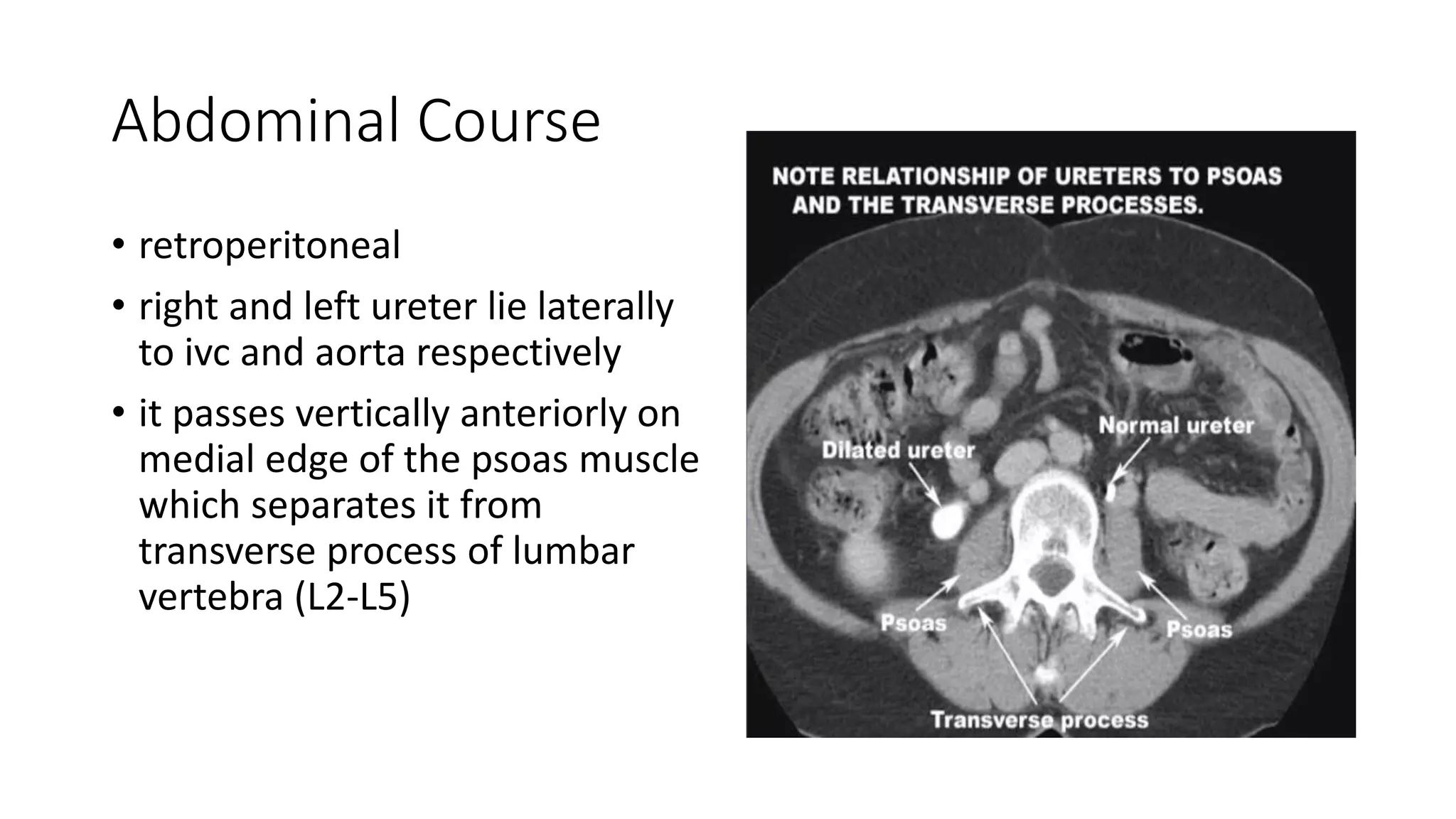 Anatomy of genitourinary system | PPTX