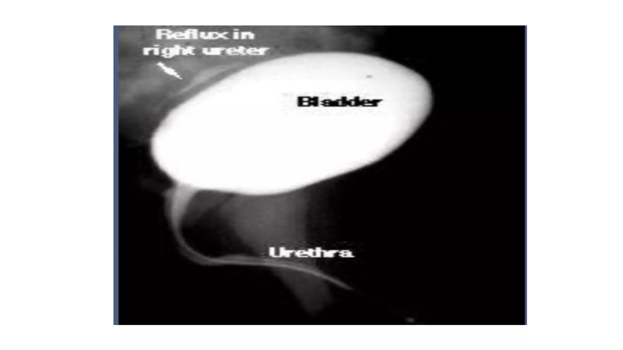 Anatomy of genitourinary system | PPTX