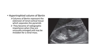 Anatomy of genitourinary system | PPTX