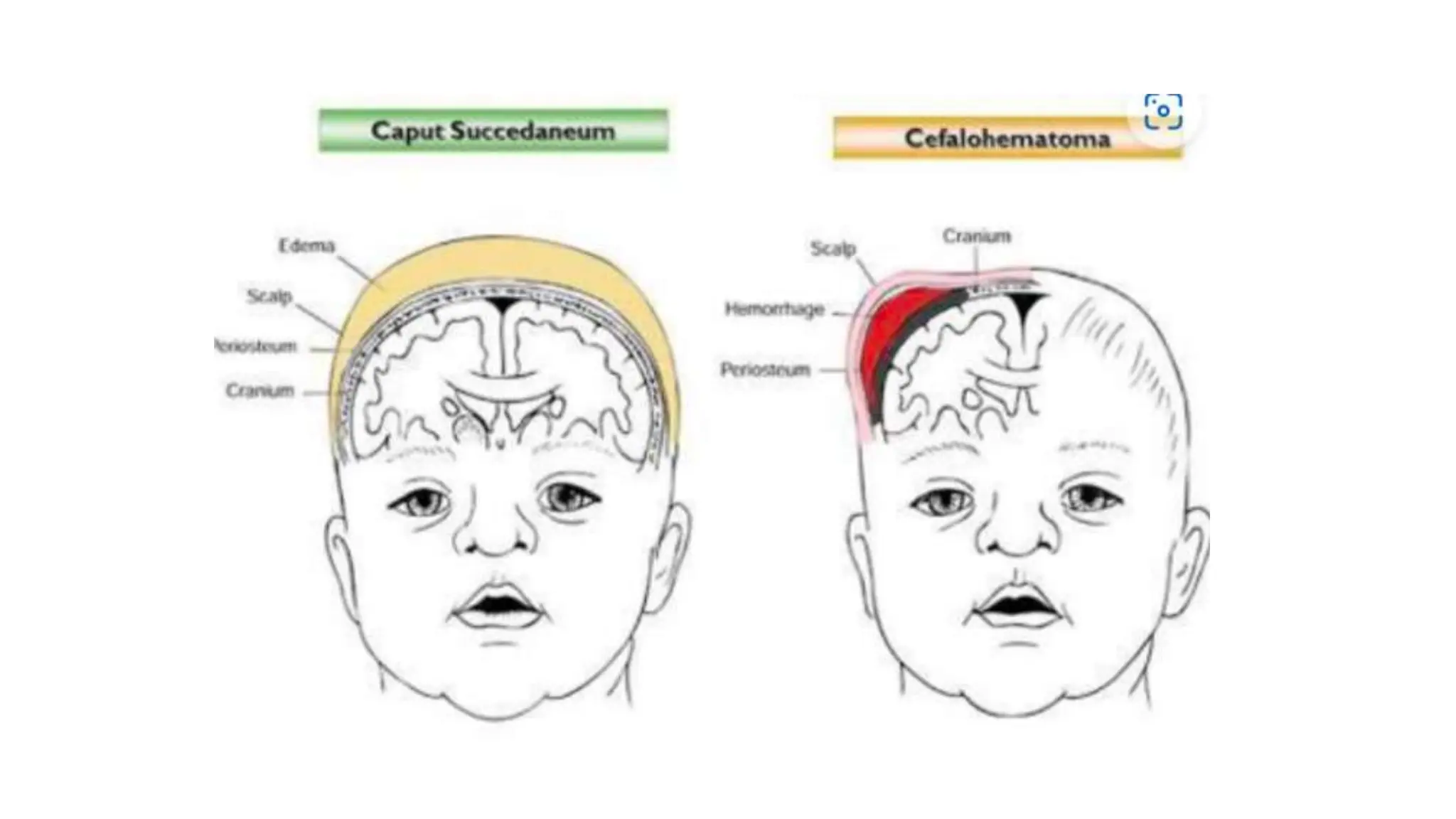 anatomy of scalp, temple and face - Copy.pptx