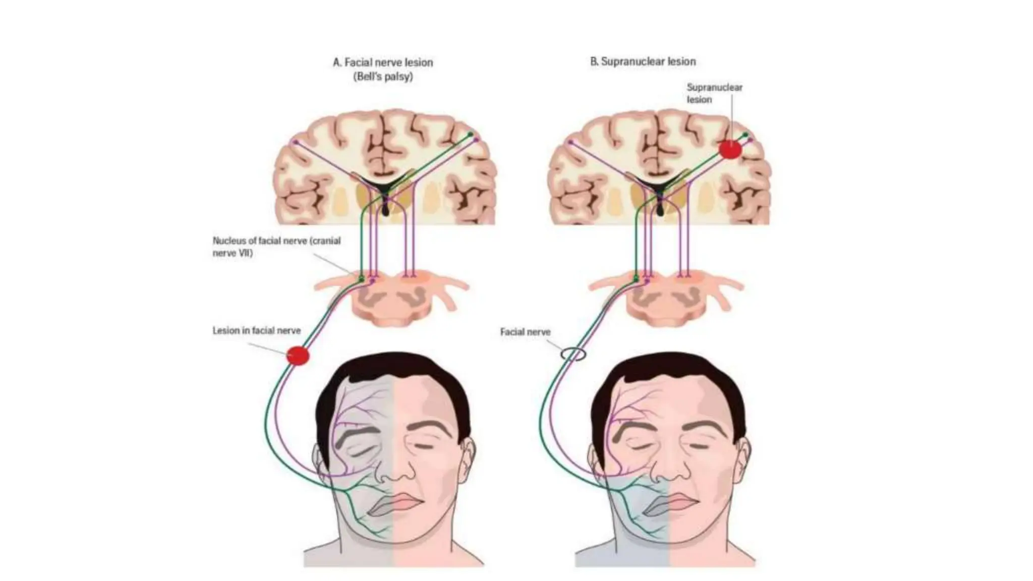 anatomy of scalp, temple and face - Copy.pptx | Death, Injury, or ...
