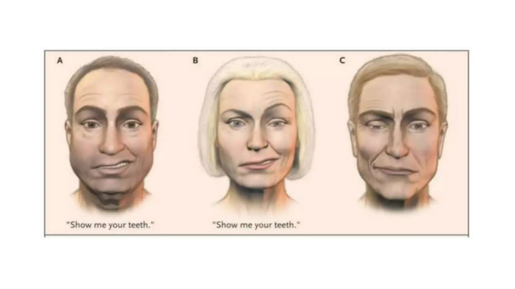 anatomy of scalp, temple and face - Copy.pptx