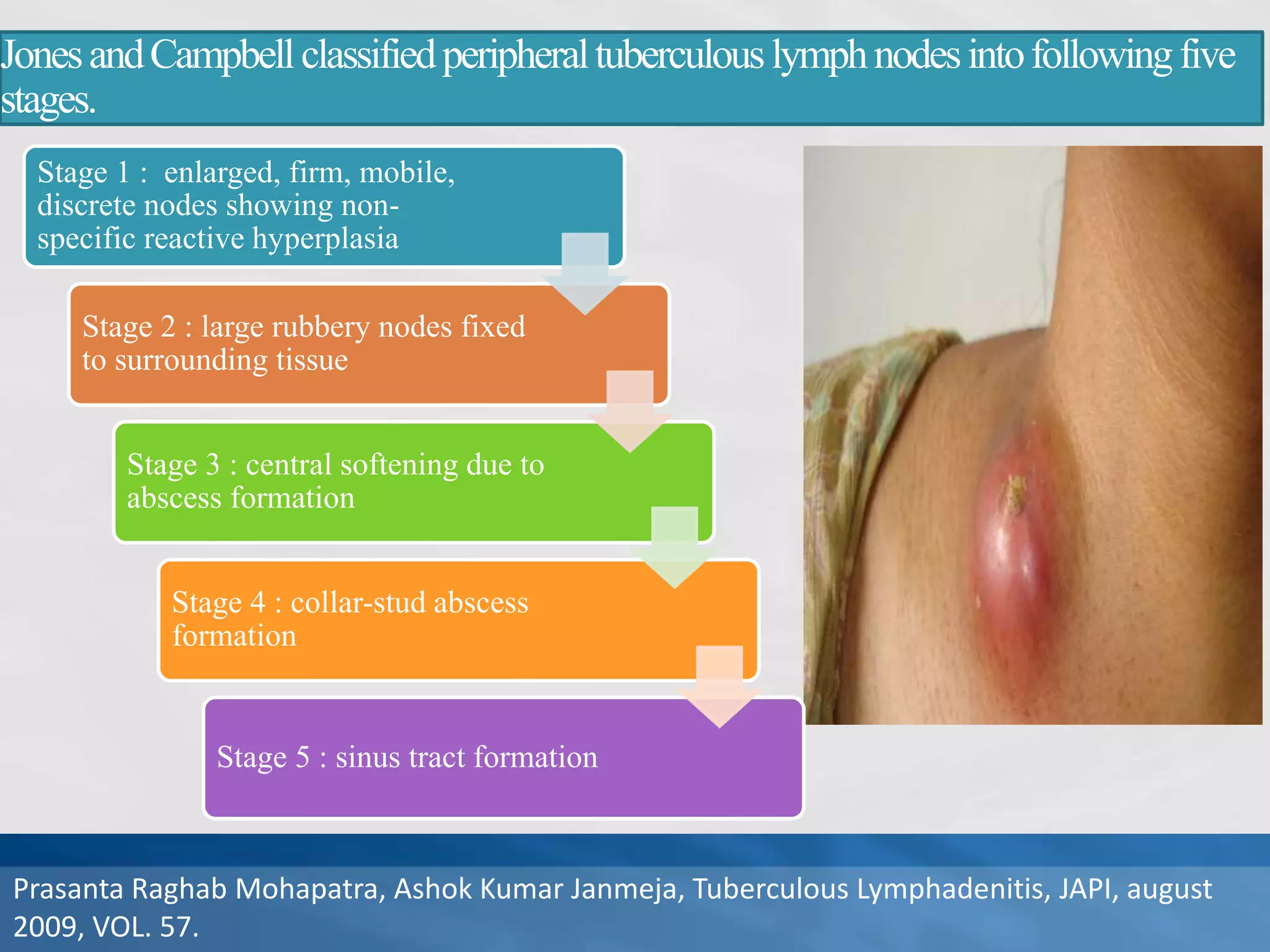 Lymph nodes of head & neck, Normal anatomy and its applied aspect | PPTX