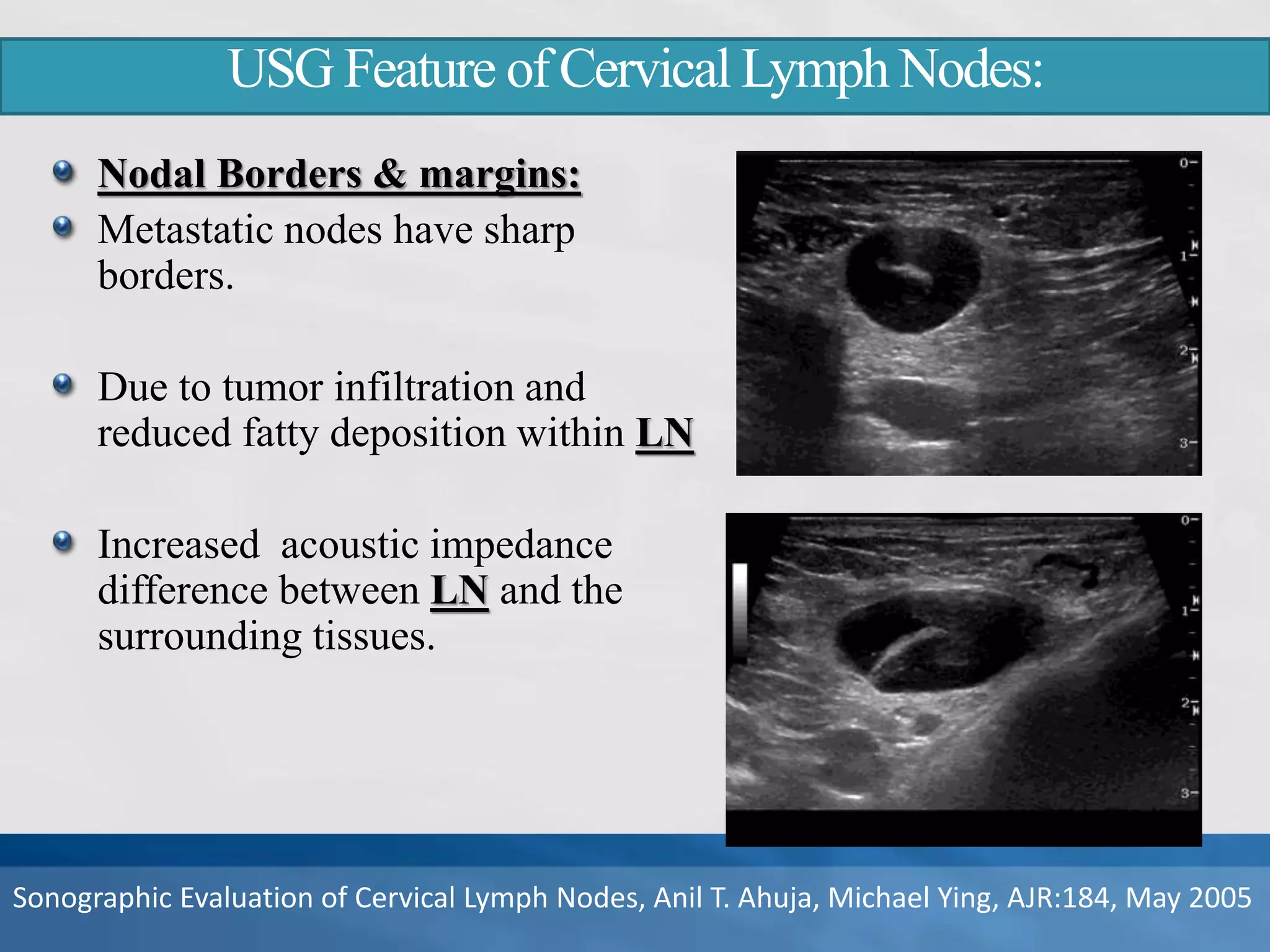 Lymph nodes of head & neck, Normal anatomy and its applied aspect | PPTX