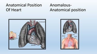 Anatomy of heart presentation | PPTX