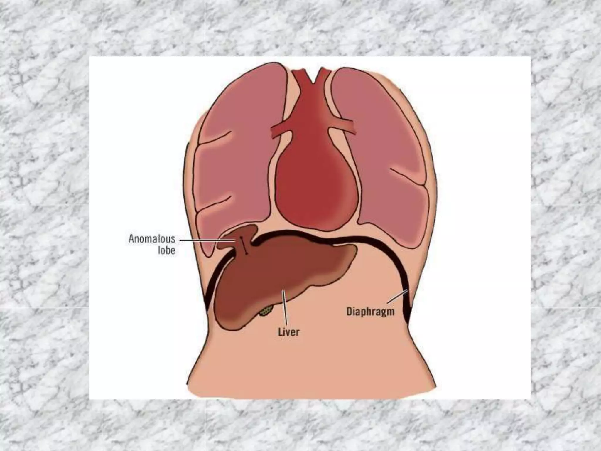 anatomy of hepatobiliary system.pptx