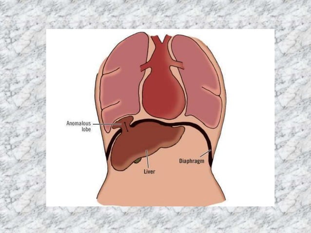 anatomy of hepatobiliary system.pptx