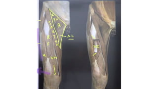 ANATOMY OF HIP JOINT topic presentation | PPTX