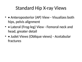 Anatomy_of_Hip_Joint_Radiologyfdssdffsssss | PPTX