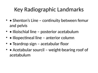 Anatomy_of_Hip_Joint_Radiology.pptxbdjdjdjjdj | PPTX