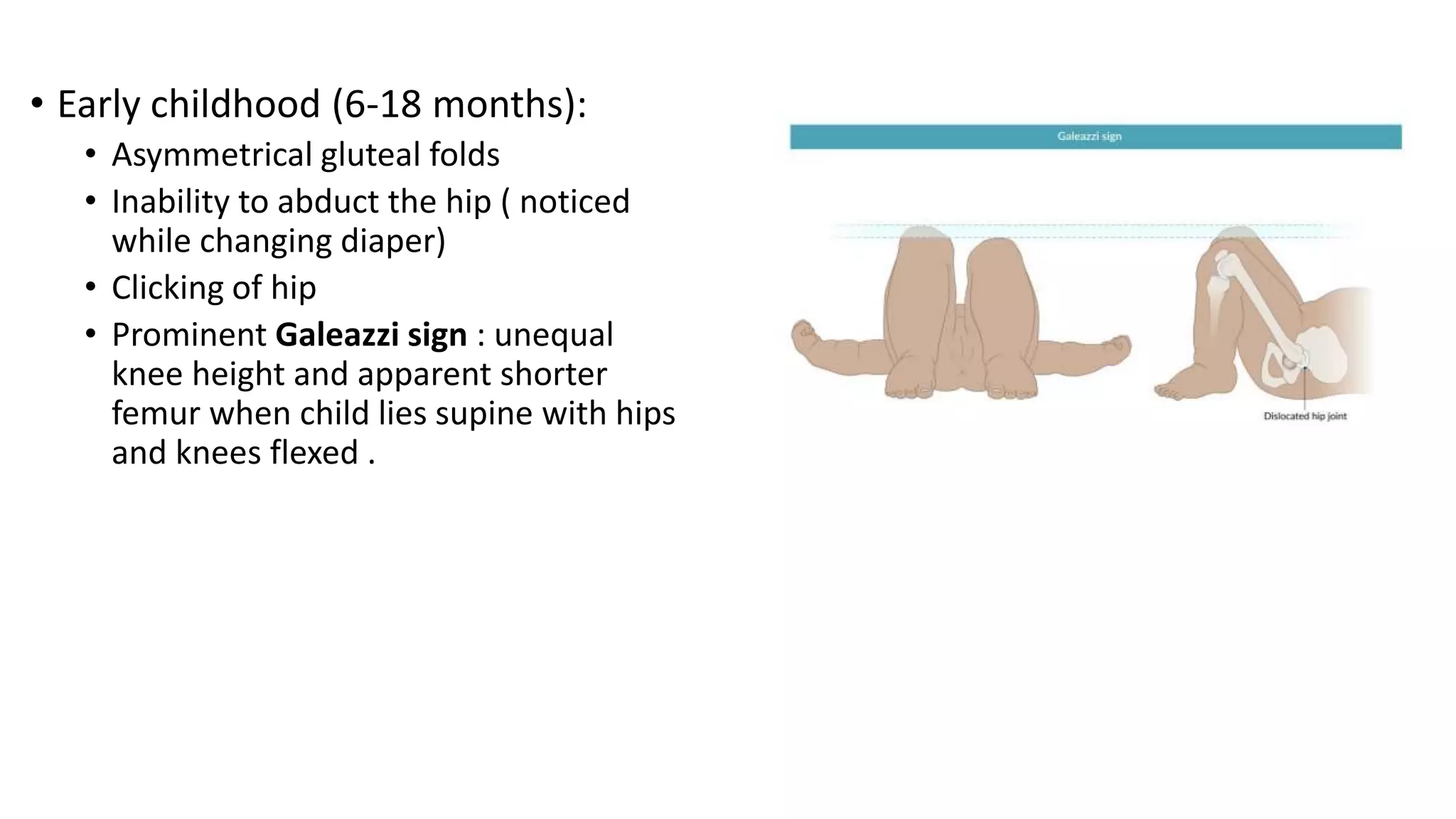 ANATOMY OF HIP JOINT , ROM & DDH.pptx