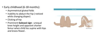 ANATOMY OF HIP JOINT , ROM & DDH.pptx