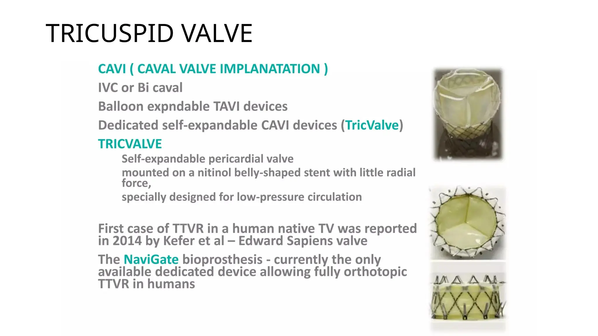 Anatomy of human heart valve and structure.pptx