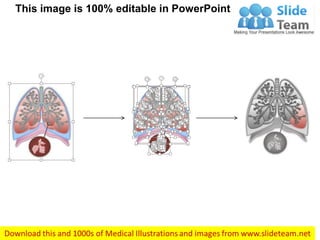 Anatomy of human lungs medical images for power point | PDF