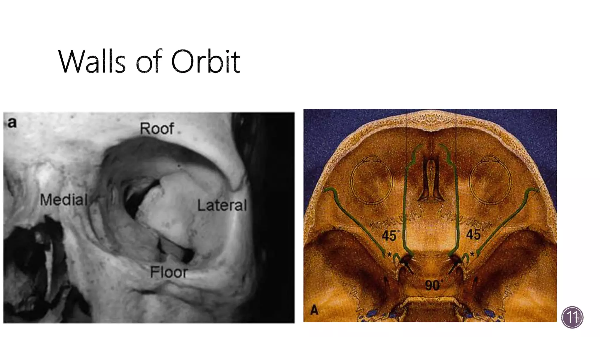 Anatomy of human orbit | PPTX