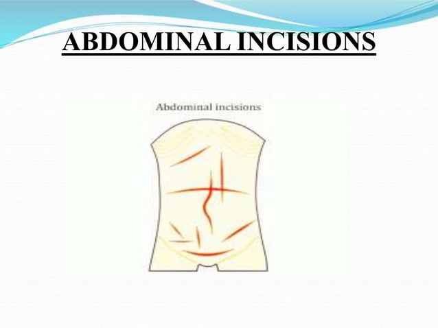anatomy of inguinal canal and abdominal incisions | PPT