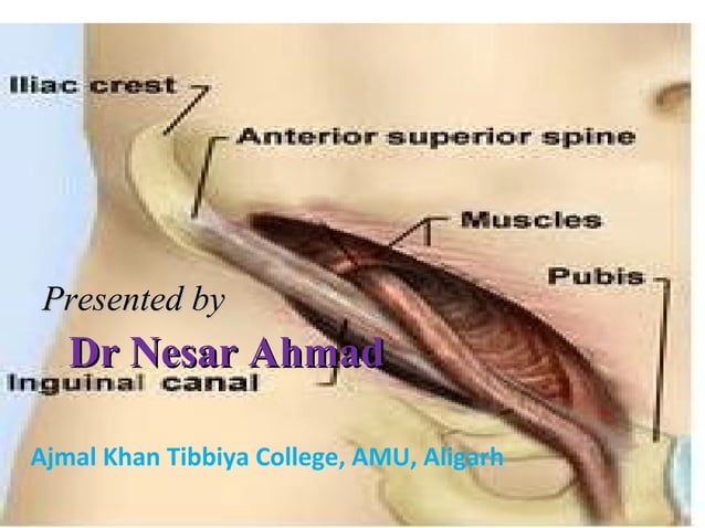 Anatomy of inguinal canal - Dr nesar Ahmad | PPT | Death, Injury, or Military Conflict ...