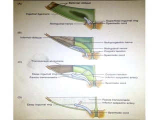 Anatomy of inguinal canal - Dr nesar Ahmad | PPT
